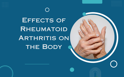 Effects of Rheumatoid Arthritis on the Body
