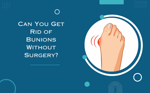 Bunion Surgery: Can You Get Rid of Bunions Without Surgery?